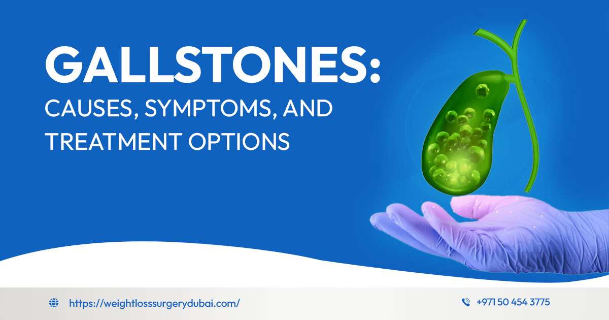 Gallstones: Causes, Symptoms, and Treatment Options