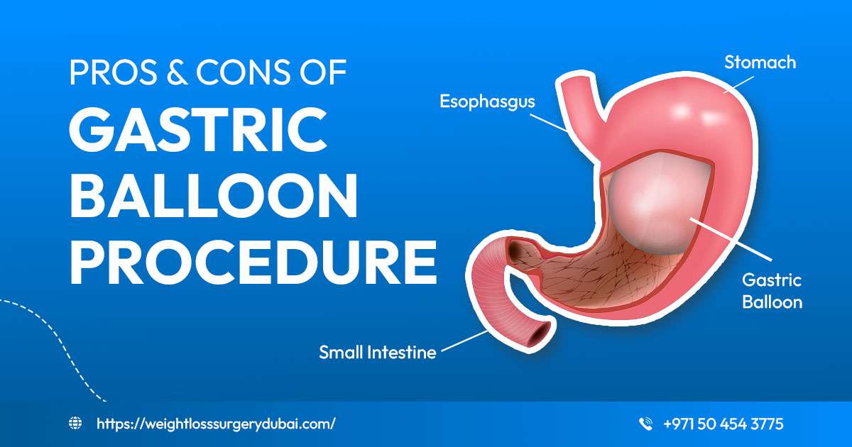 Pros and Cons of Gastric Balloon Procedure